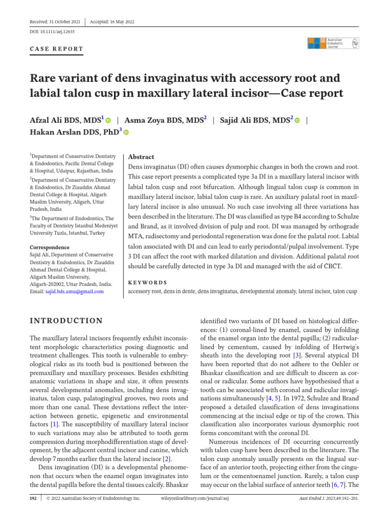 Rare Variant of Dens Invaginatus With Accessory Root and Labial Talon ...