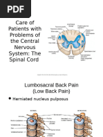 Lumbar Disc Nomenclature 2.0 | PDF | Vertebral Column | Medical Diagnosis