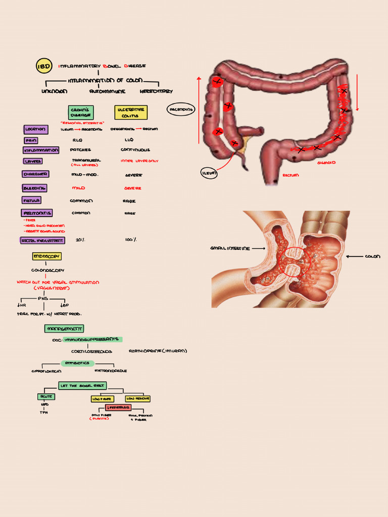 IBD | PDF