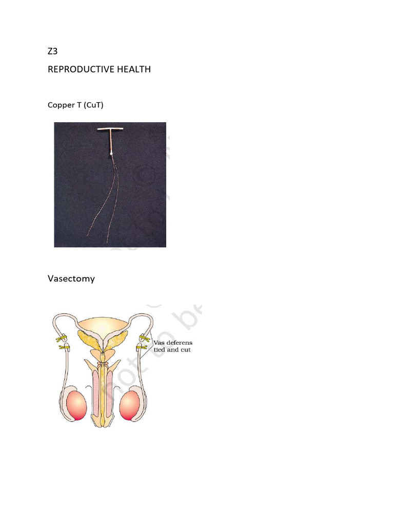 Z3 Reproductive Health: Copper T (Cut) | PDF