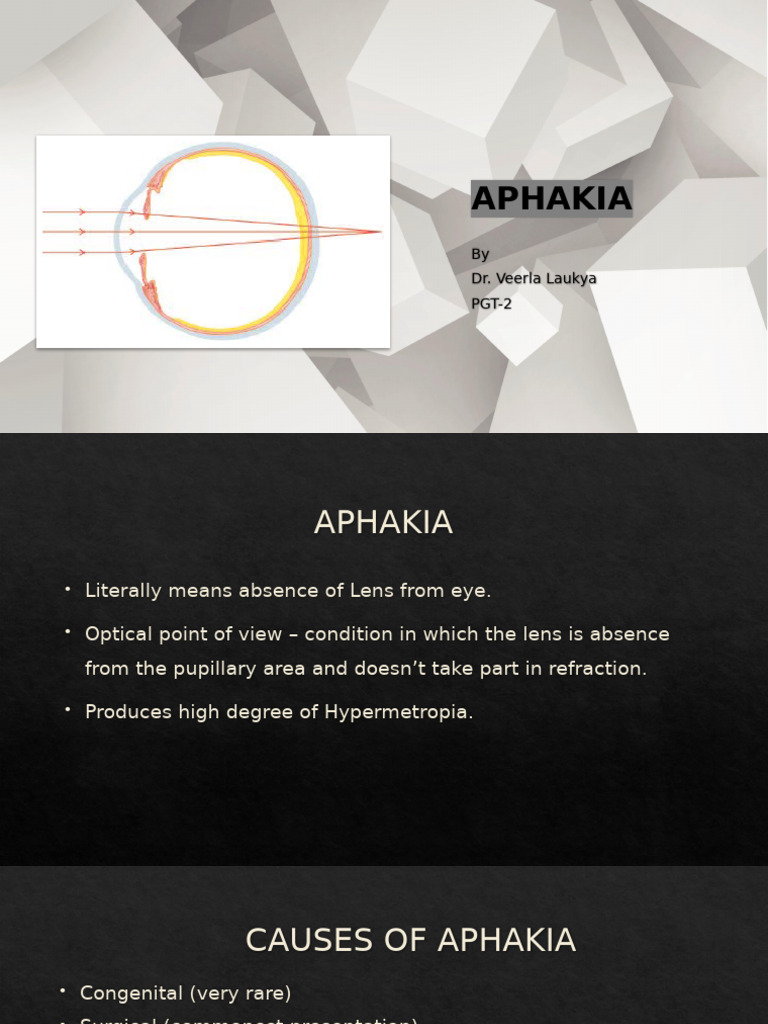 Understanding Aphakia: Causes and Treatment | PDF | Glasses | Eye