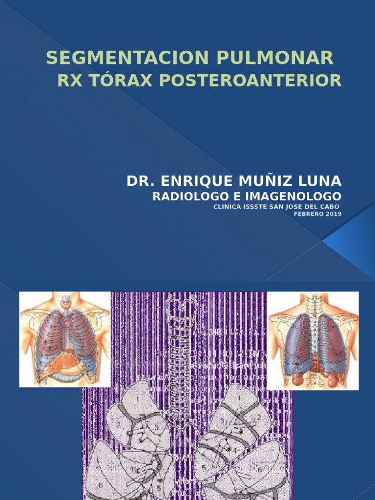 Segmentacion Pulmonar RX Tórax Posteroanterior Presentacion | PDF