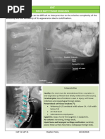 Soft Tissue Neck X-Ray Overview | PDF | Larynx | Neck