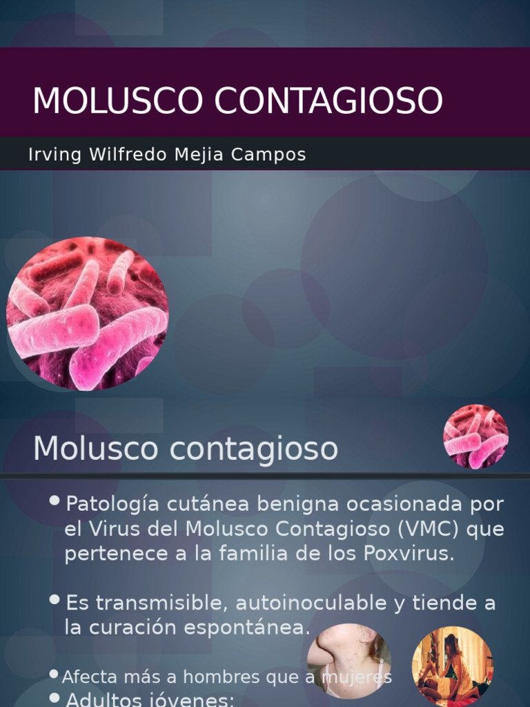 Molusco Contagioso | PDF | Virus | Medicina CLINICA