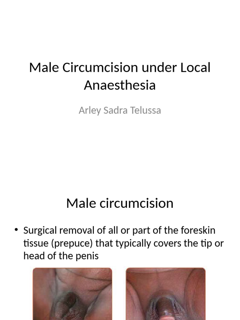 Male Circumcision | PDF | Circumcision | Sexual Anatomy