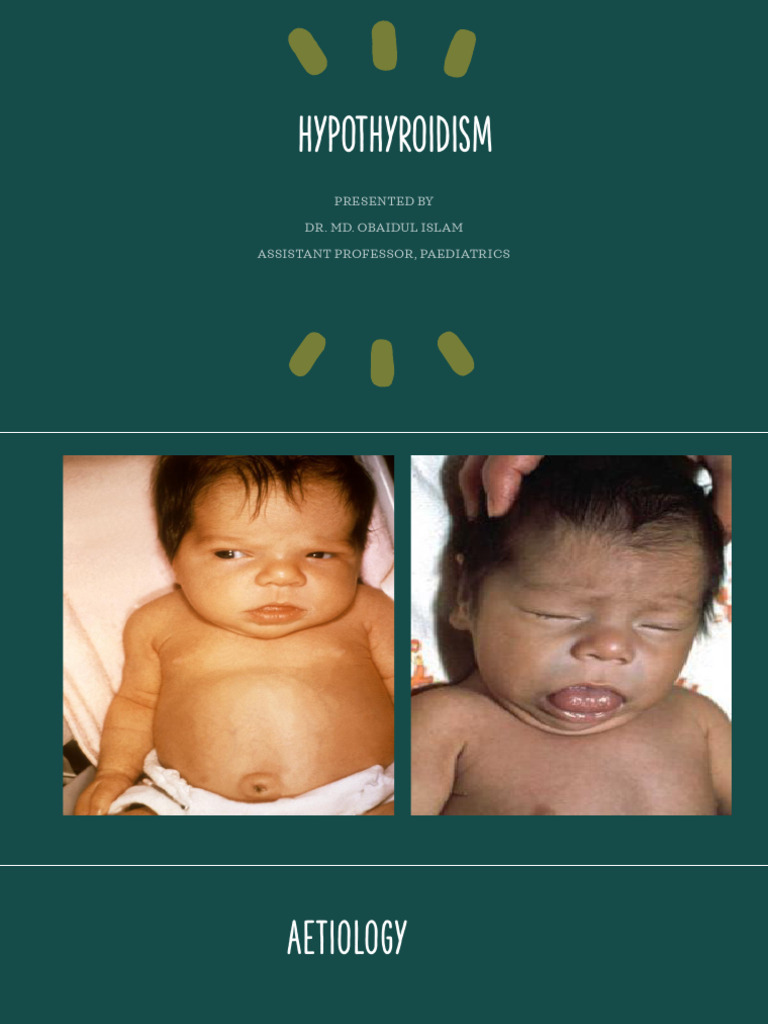 Presentation - Hypothyroidism - Original | PDF