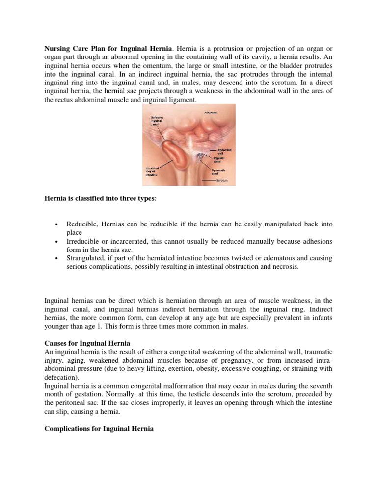 Nursing Care Plan For Inguinal Hernia HB | PDF | Health Care | Health ...