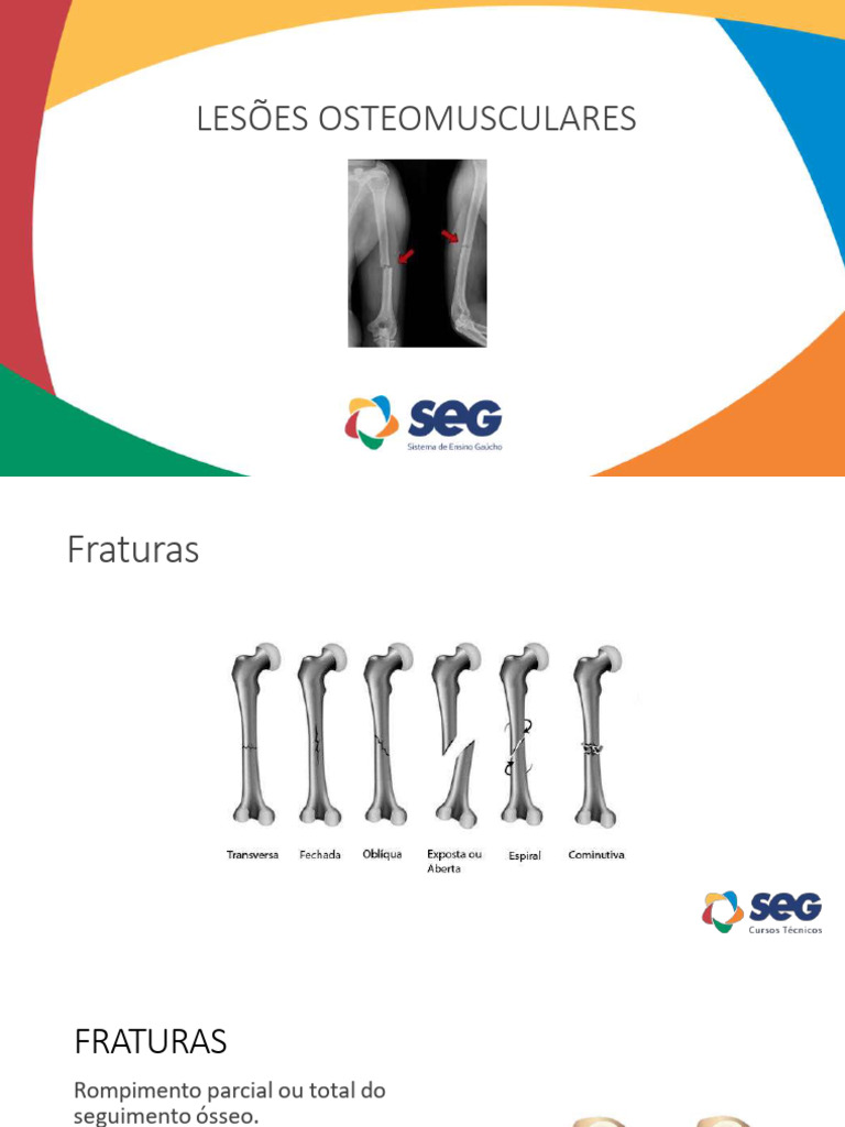 Lesões Osteomusculares: Fraturas e Contusões | PDF | Doenças e ...