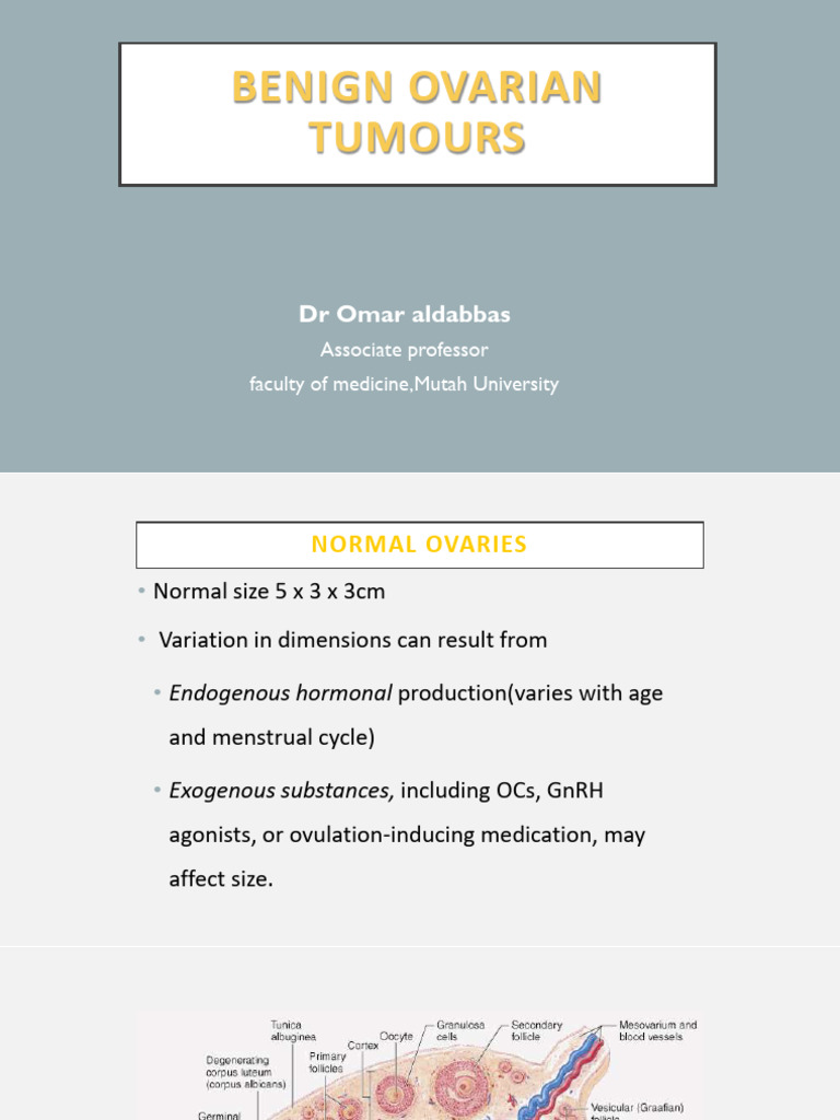 Benign Ovarian Tumor DR Omar | PDF | Ovarian Cancer | Ovary