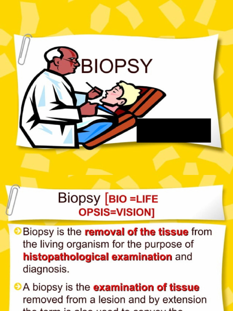 Understanding Biopsy in Dentistry | PDF