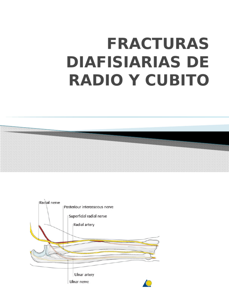 Trauma y Fractura de Radio y Cubito Distal | PDF | Mano | Codo