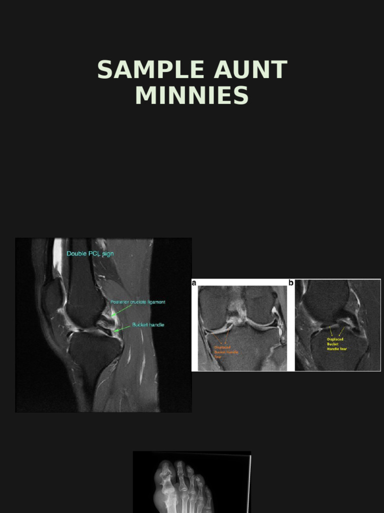 Aunt Minnies Radiology Cases | PDF