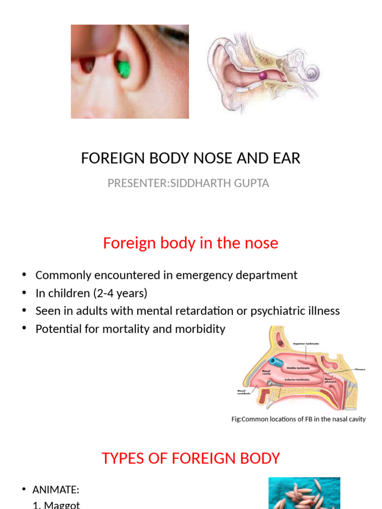 Foreign Body Nose and Ear | PDF | Human Nose | Diseases And Disorders