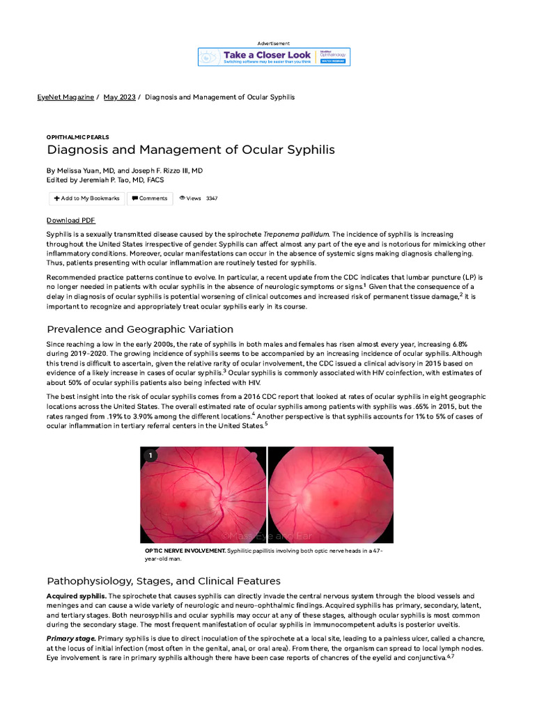 Ocular Syphilis: Diagnosis and Management | PDF | Serology | Clinical ...