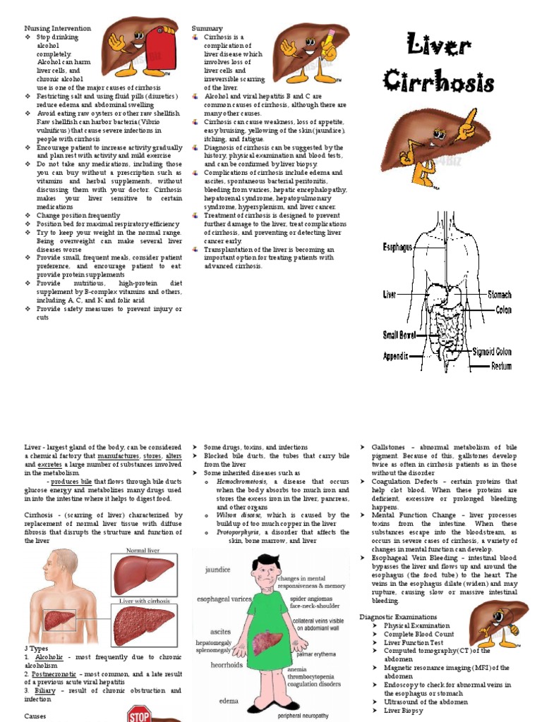 Liver Cirrhosis | Cirrhosis | Liver