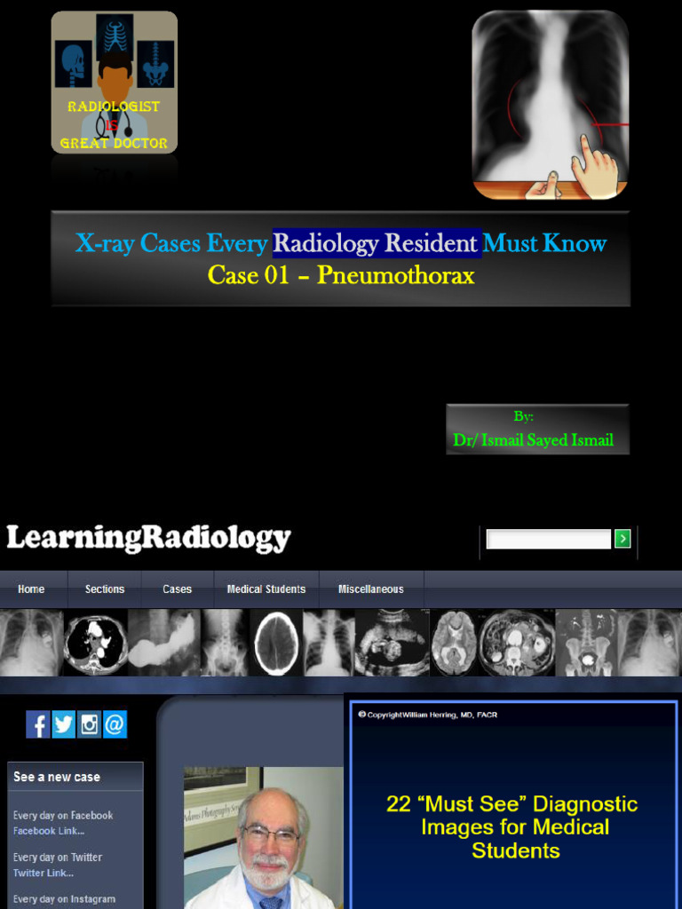Xraycases Radiologyresidents Mustknow 211128022706 | PDF | Aorta ...