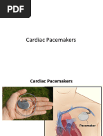 Pacemaker Block Diagram Explanation | PDF