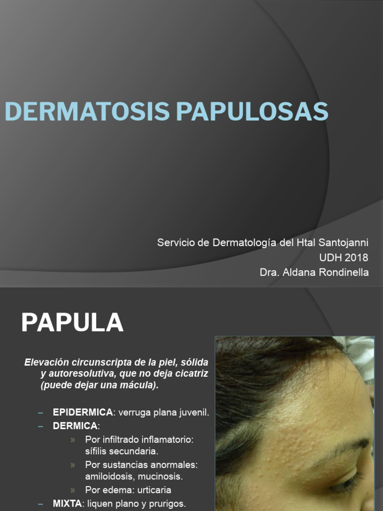 Dermatosis Papulosas: Tipos y Tratamientos | PDF | Especialidades ...