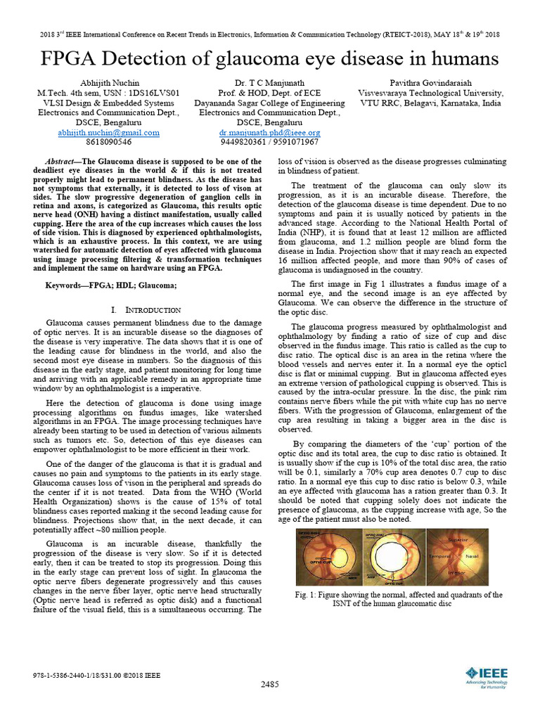 FPGA Detection of Glaucoma Eye Disease in Humans | PDF | Glaucoma | Ophthalmology