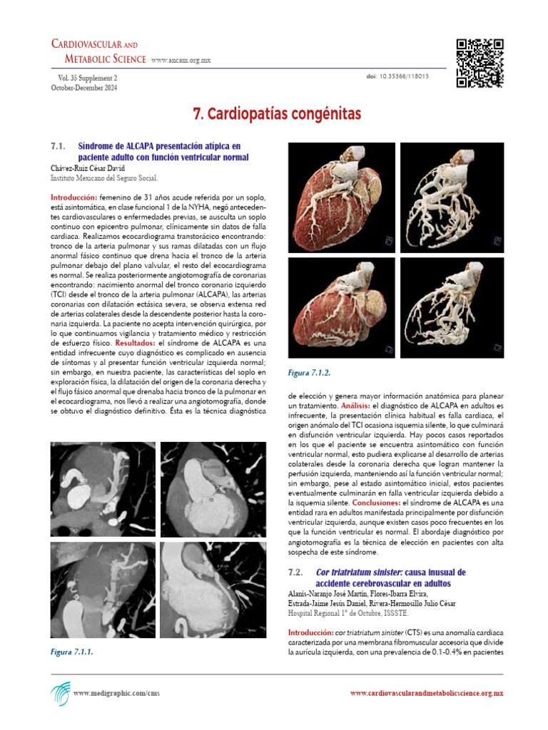 Diagnóstico de ALCAPA en Adultos Asintomáticos | PDF | Corazón ...