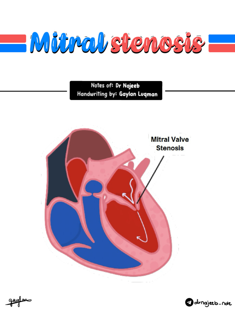 Understanding Mitral Stenosis Symptoms | PDF | Diastole | Ventricle (Heart)