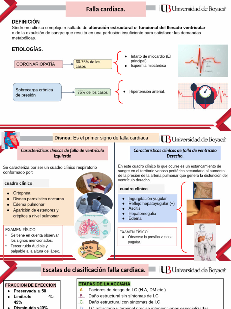Falla Cardíaca: Definición y Clasificación | PDF | Insuficiencia ...