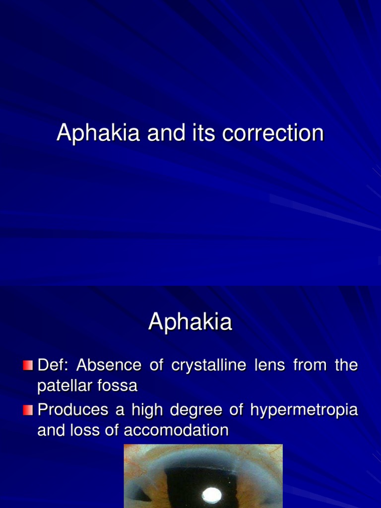 Aphakia | PDF | Cornea | Glasses
