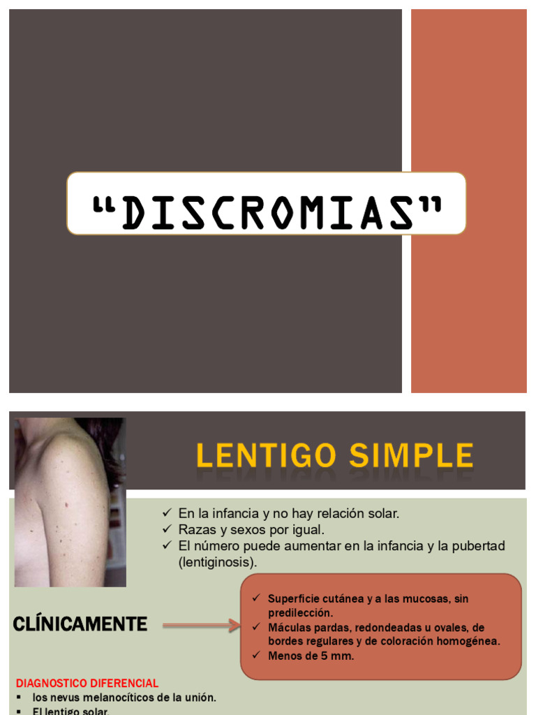 Discromías en la piel: tipos y tratamientos | PDF | Piel ...