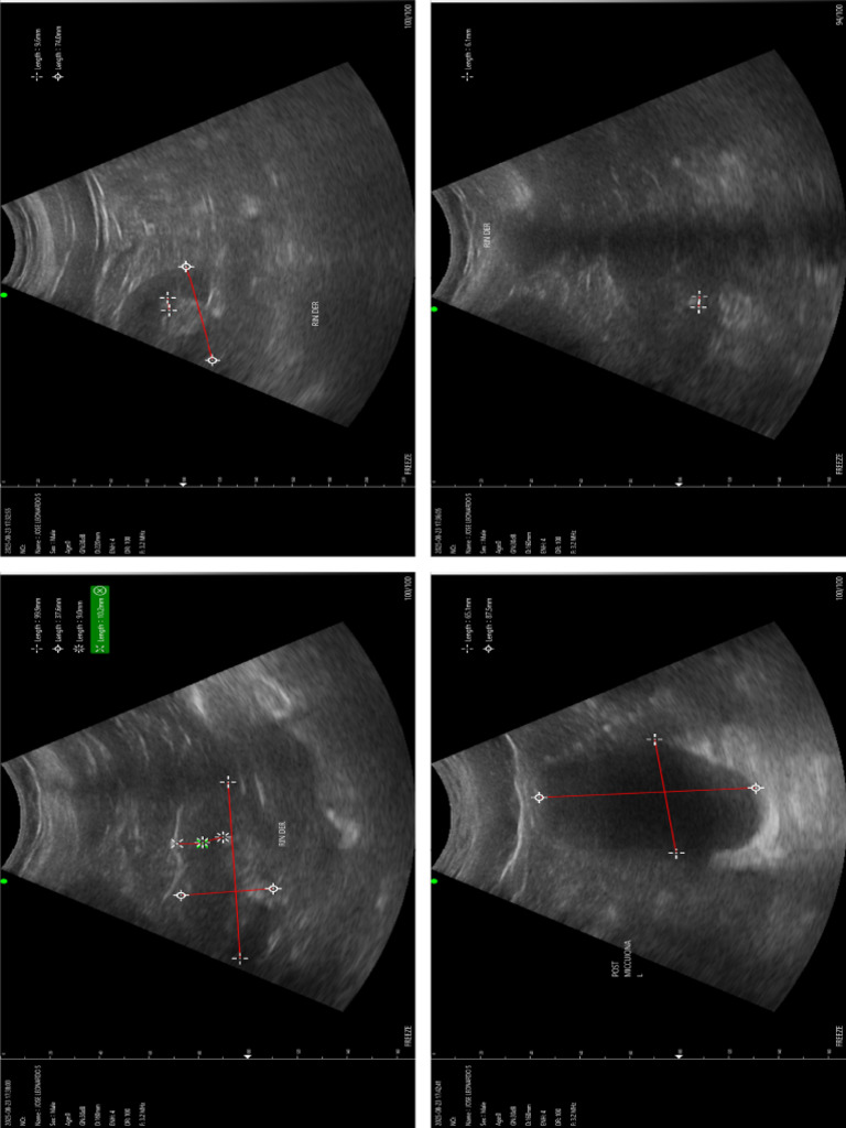 Usg Pelvis | PDF