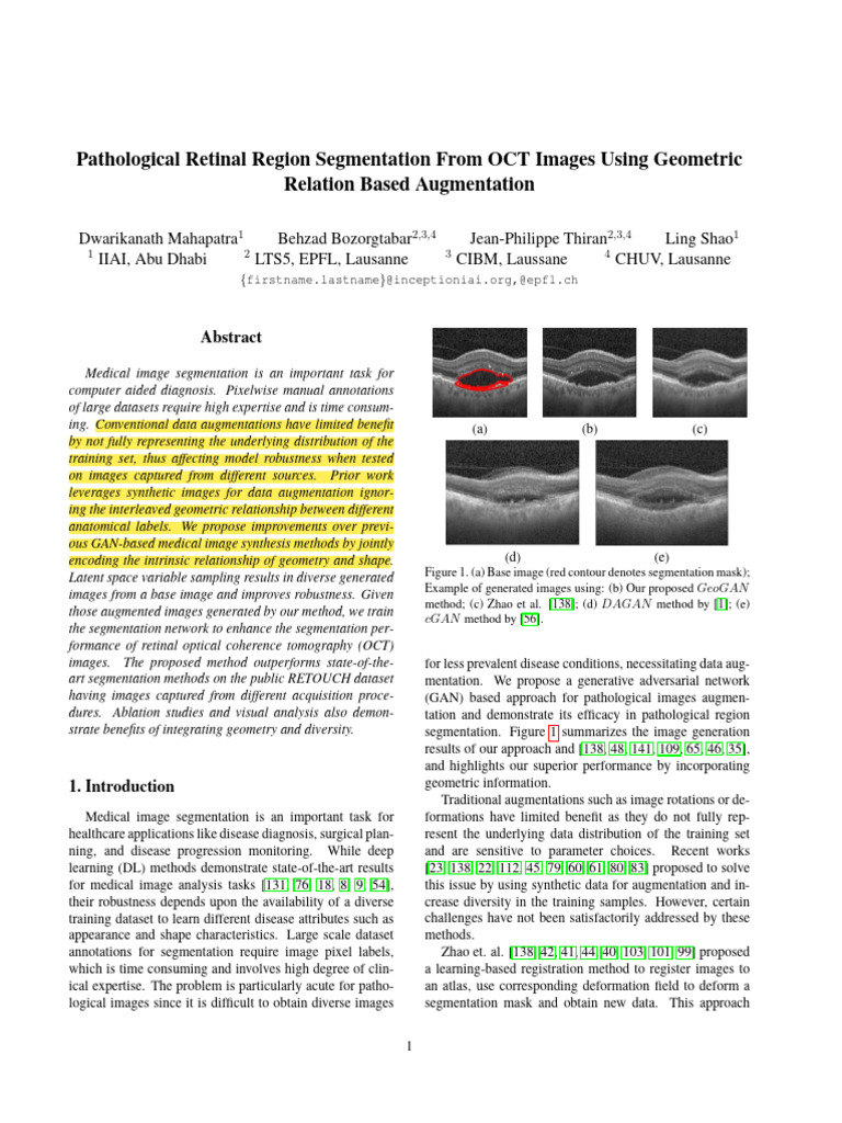 Pathological Retinal Region Segmentation From OCT Images Using ...
