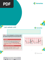 Ecg Interpretation J Point Stemi Criteria Equivalents and Others | PDF ...