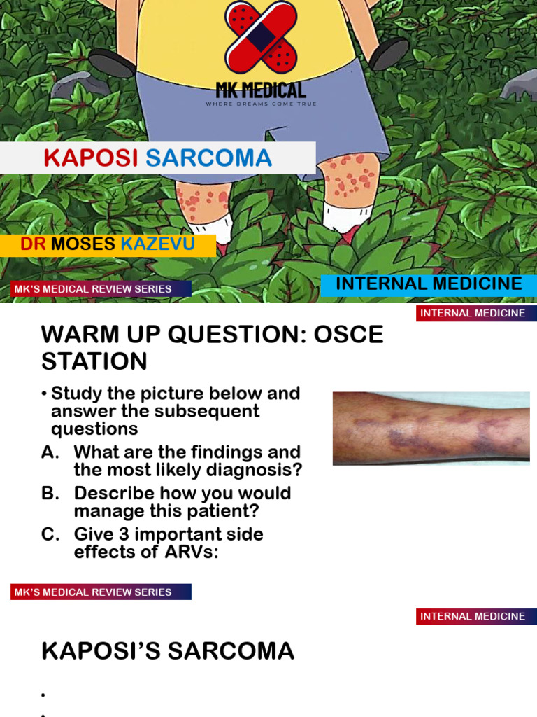 Understanding Kaposi Sarcoma: Overview and Management | PDF | Medical ...