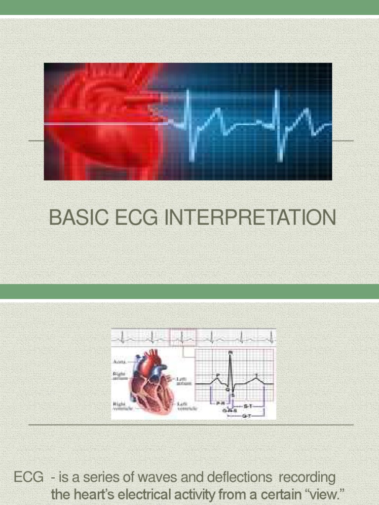Basic ECG Interpretation Guide | PDF | Electrocardiography | Heart Rate