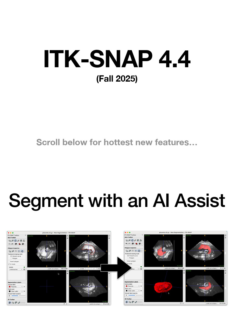 What's New in ITK-SNAP 4.4? | PDF