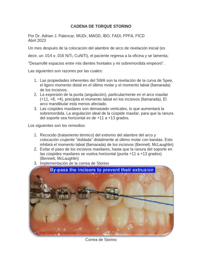 Torque Storino | PDF