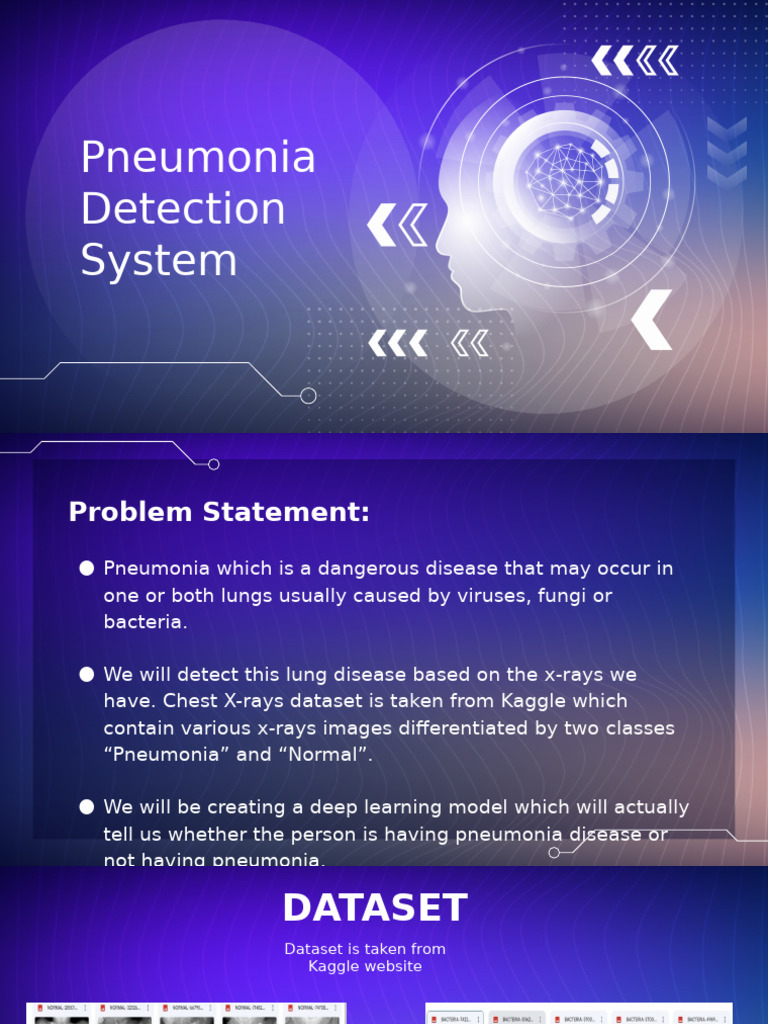 AI Pneumonia Calssification | PDF