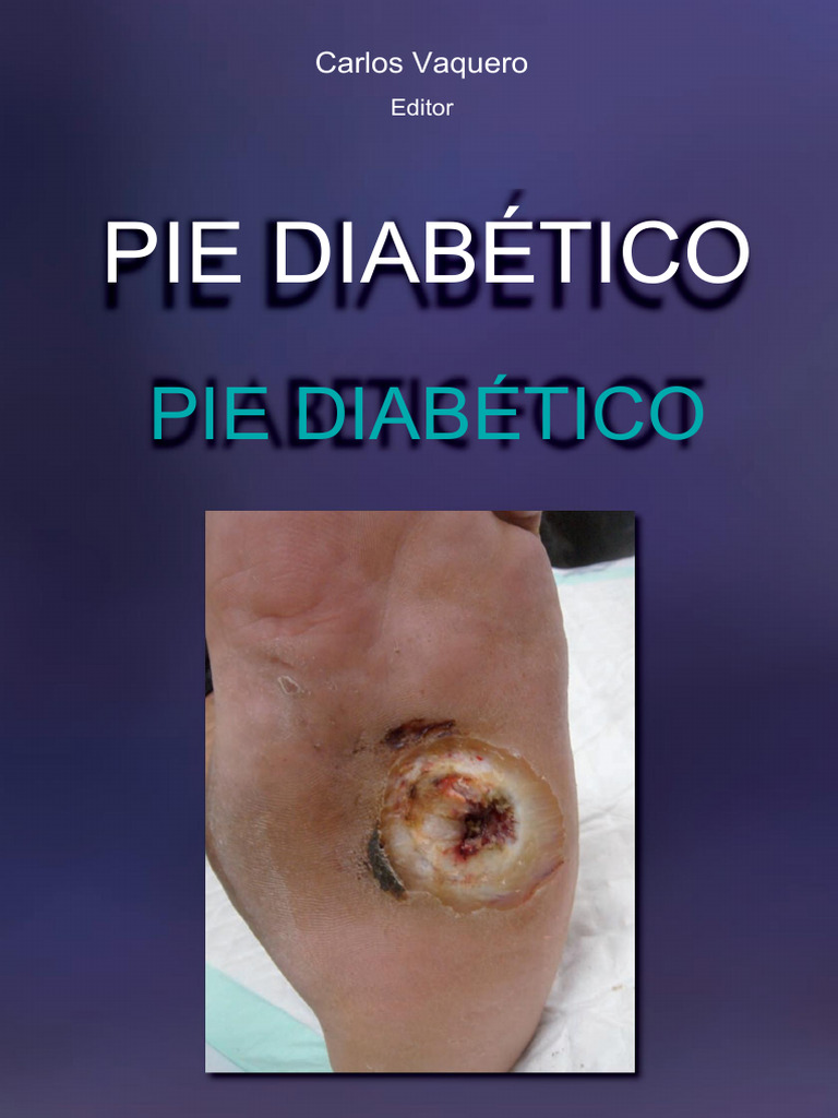 Pie-Diabetico-Diabetic-Foot-Traducido Español | PDF | Diabetes | Pie