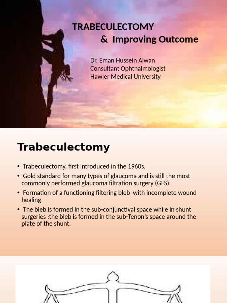 Trabeculectomy, Improving Out Come | PDF | Glaucoma | Surgical Suture