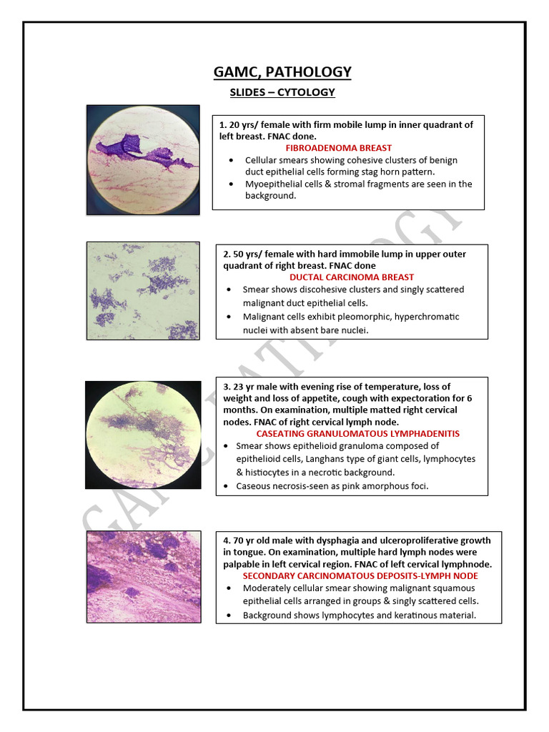 Breast and Lymph Node Cytology Cases | PDF | Cytopathology | Thyroid