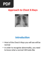 Hilum Overlay Sign in Chest Imaging | PDF