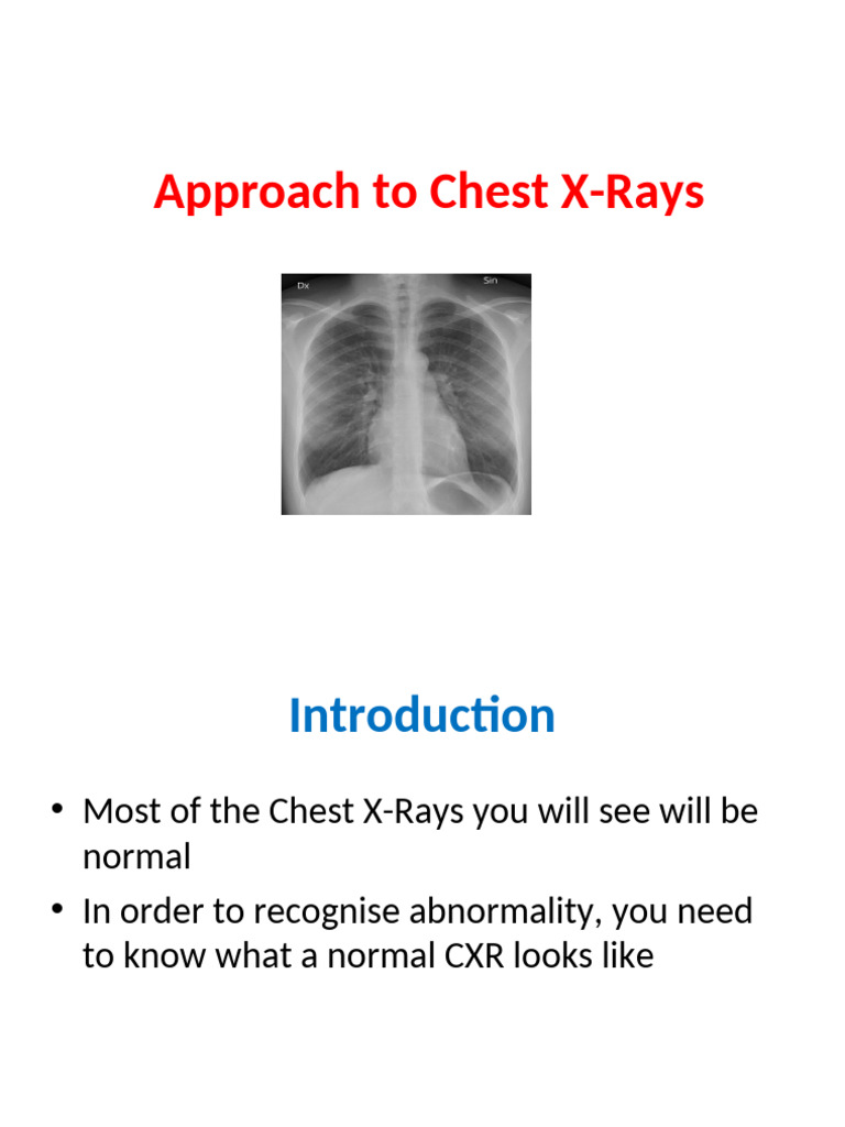 Approach To Chest X-Rays | PDF | Thorax | Thorax (Human Anatomy)