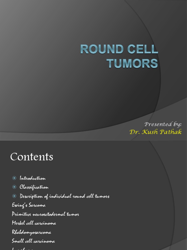 Round Cell Tumors Final | PDF | Lymphoma | Metastasis