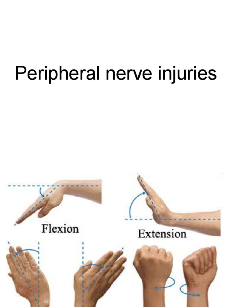 Peripheral Nerve Injury | PDF | Elbow | Thumb