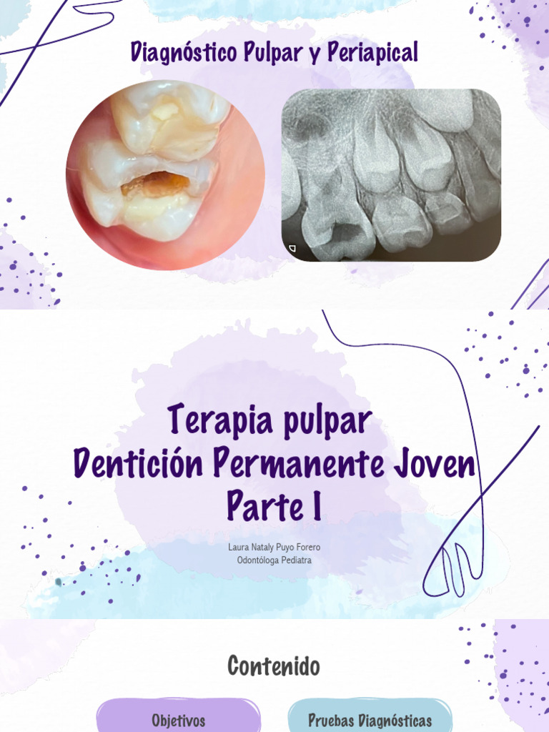 Diagnóstico Pulpar y Periapical en Dentición Permanente Joven | PDF ...