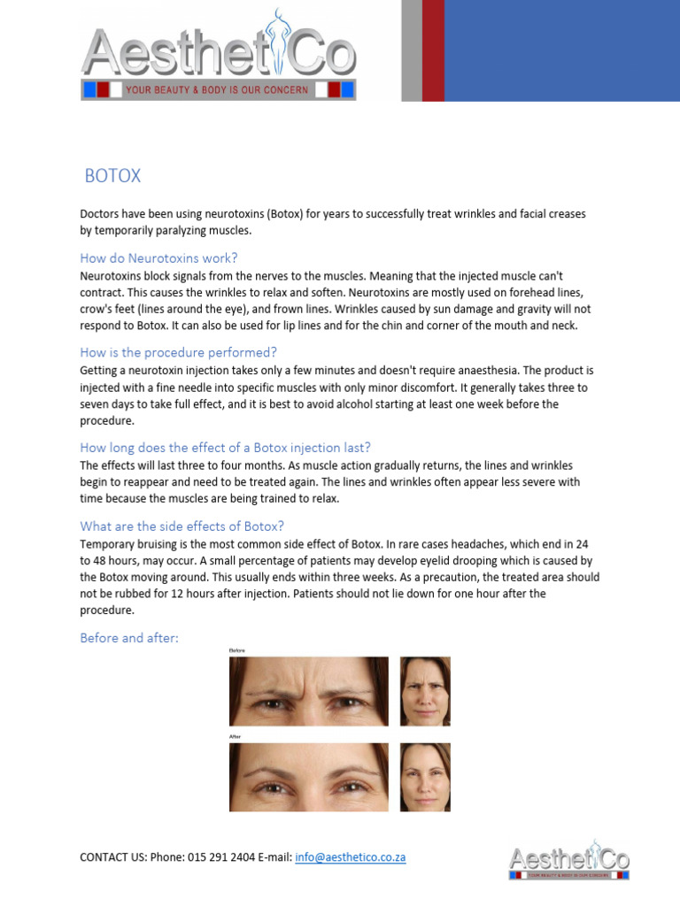Botox Procedure Guidelines and Effects | PDF