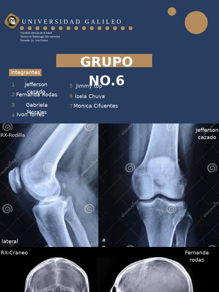 Radiografias Grupo No.6 | PDF
