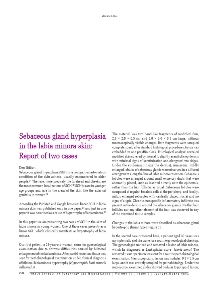Sebaceous Gland Hyperplasia in The Labia Minora.52 | PDF | Skin | Labia