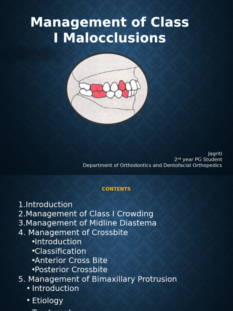 Class I Malocclusion Management Guide | PDF | Dental Anatomy | Orthodontics