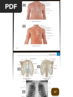 Anatomy Heart Cadaver | PDF | Heart Valve | Coronary Circulation