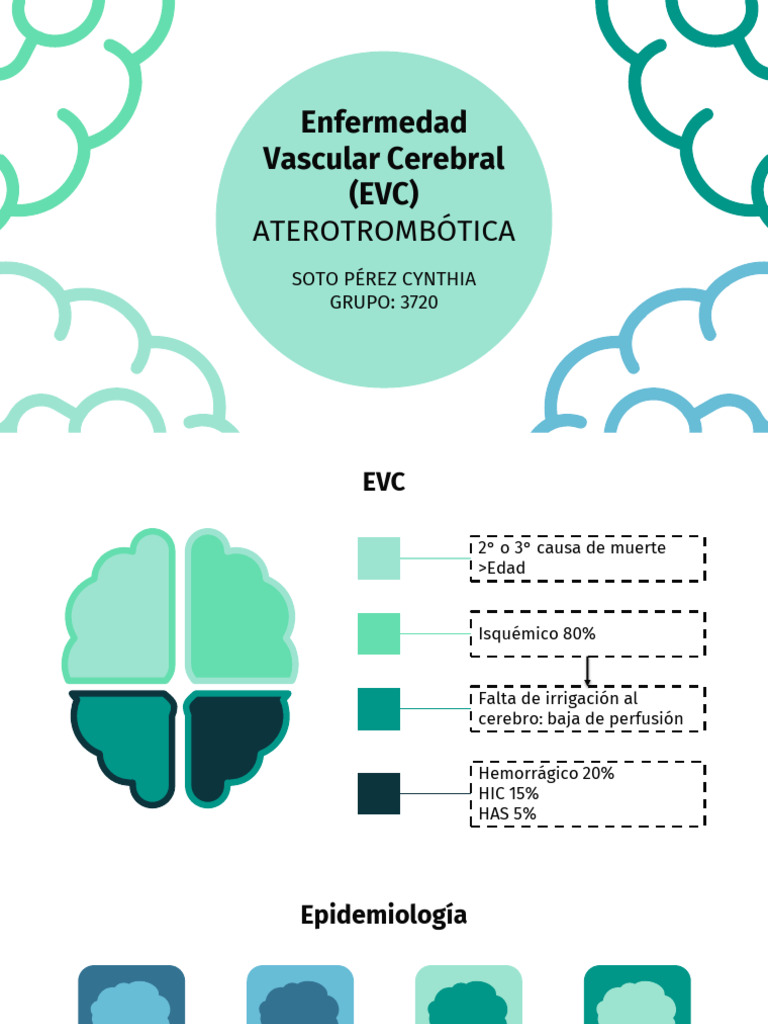 EVC Isquémico | PDF | Carrera | Isquemia